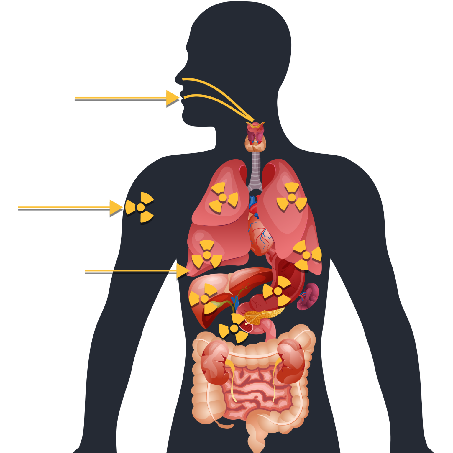 Les risques physiques